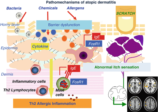 Evolution of Animal Models of Atopic Dermatitis | SpringerLink