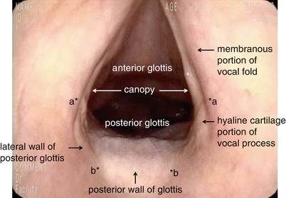 Histoanatomy of the Human Glottis | SpringerLink