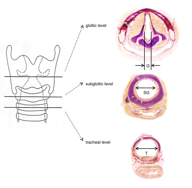 Histoanatomy of the Human Glottis | SpringerLink