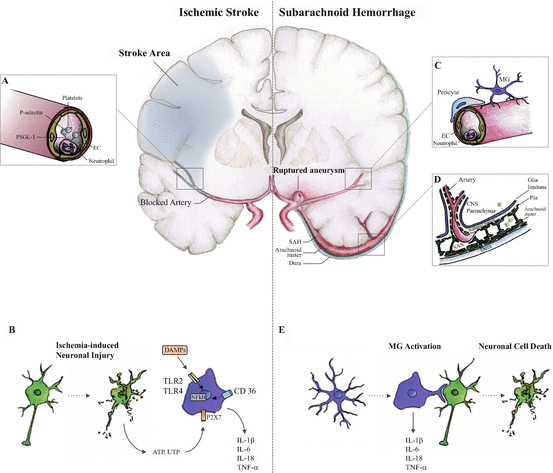 Microglia Function in Stroke | SpringerLink