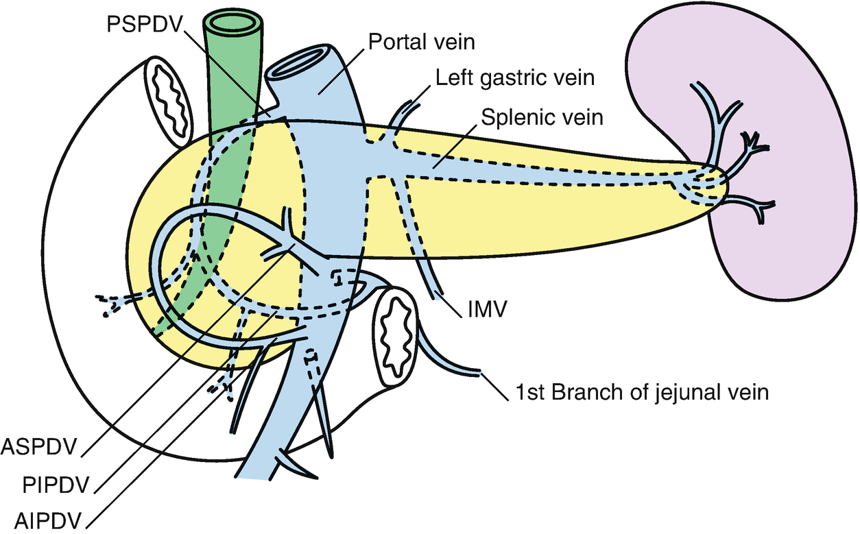 Surgical Anatomy of the Pancreas and the Periampullary Region ...