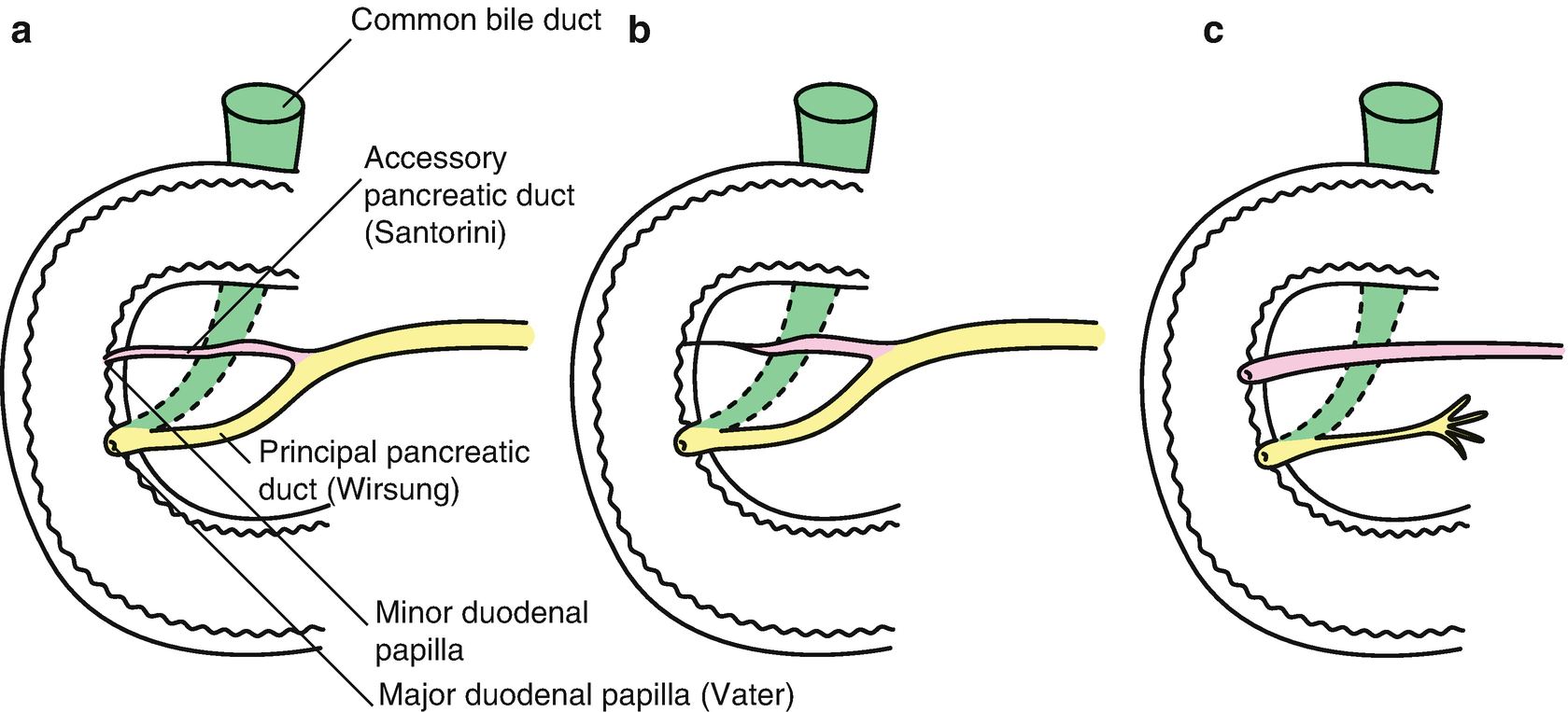 Surgical Anatomy of the Pancreas and the Periampullary Region ...