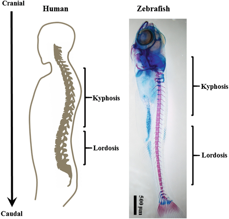 Emergence of Zebrafish as a Model System for Understanding Human ...