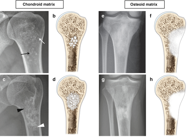 Basic Concepts and Diagnostic Parameters | SpringerLink