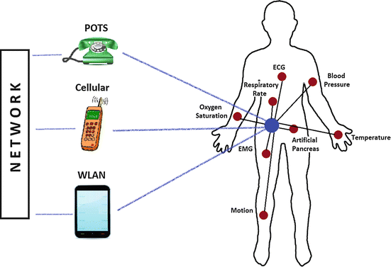 Implanted Antennas in Biomedical Telemetry | SpringerLink