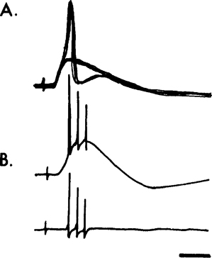 Extracellular Single-Unit Recording Methods | SpringerLink