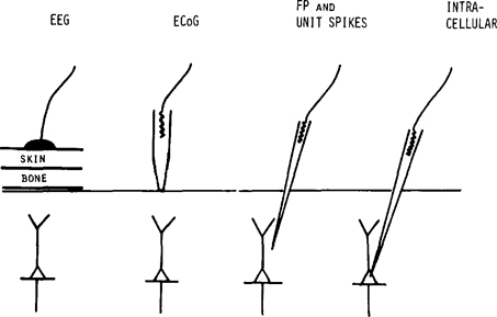 Extracellular Single-Unit Recording Methods | SpringerLink