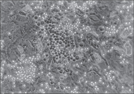 The Cobblestone-Area-Forming Cell Assay | SpringerLink