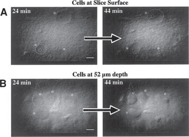Patch-Clamp Techniques Applied To Brain Slices | SpringerLink
