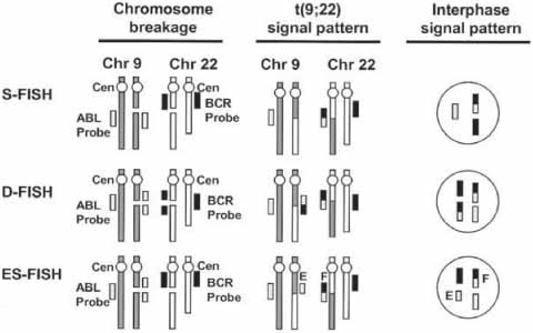 Interphase FISH Studies of Chronic Myeloid Leukemia | SpringerLink