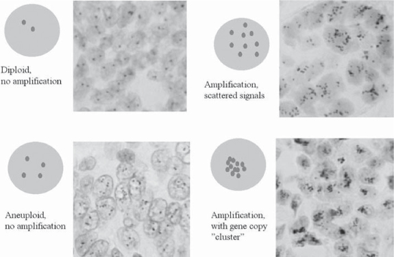 Chromogenic In Situ Hybridization in Tumor Pathology | SpringerLink