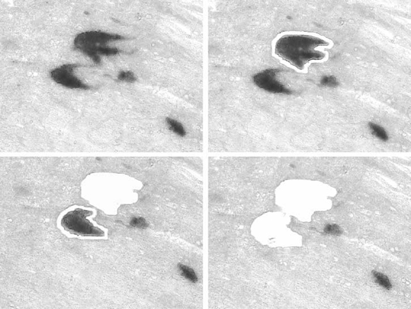 Single-Cell Laser-Capture Microdissection and RNA Amplification ...