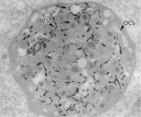 Electron Microscopy Methods for Studying Platelet Structure and ...
