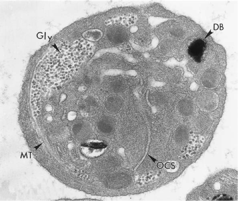 Electron Microscopy Methods for Studying Platelet Structure and ...