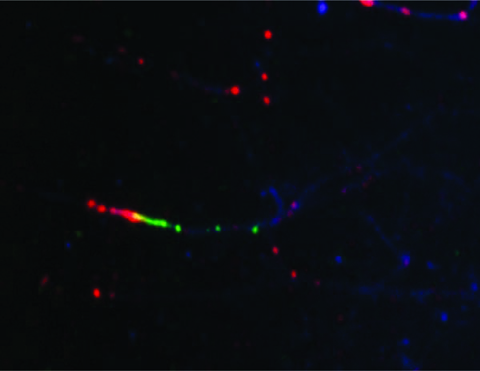 Fiber-FISH: Fluorescence In Situ Hybridization on Stretched DNA ...