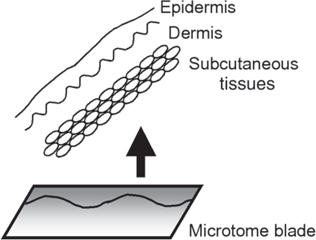 Animal Models of Scleroderma | SpringerLink