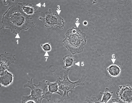 Cell-Spreading Assays | SpringerLink