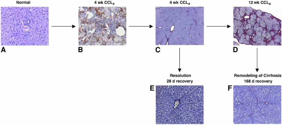 Modeling Liver Fibrosis in Rodents | SpringerLink