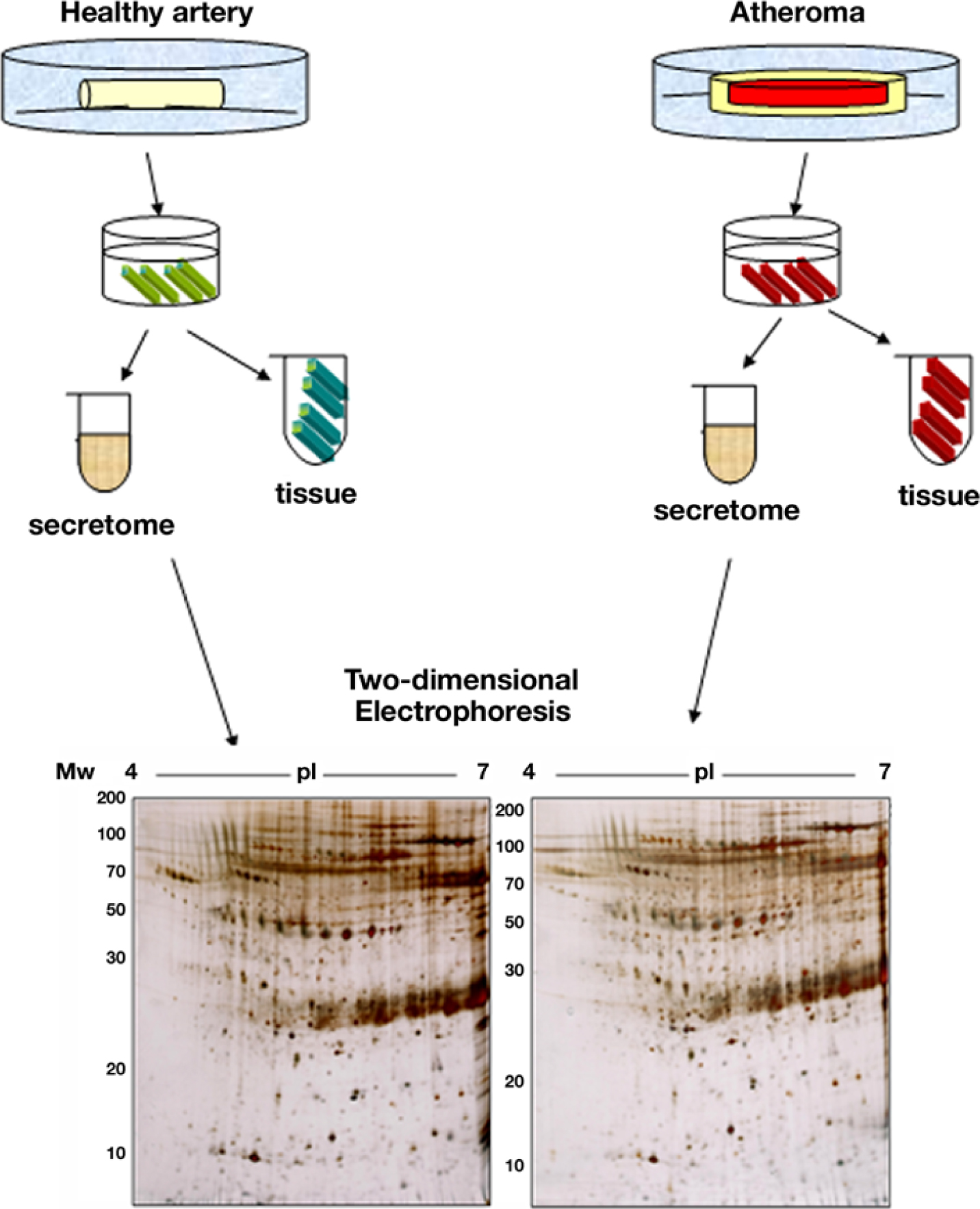 Characterization of the Human Atheroma Plaque Secretome by Proteomic ...