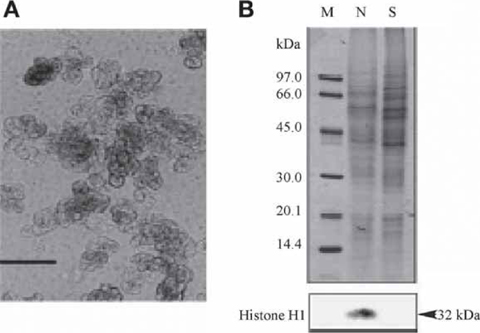 Extraction of Nuclear Proteins | SpringerLink
