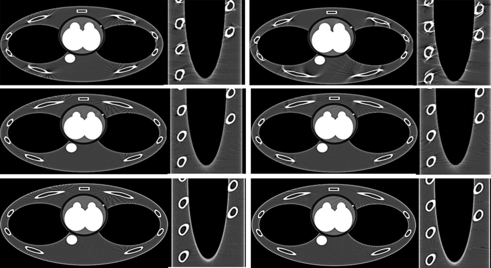 Multi-slice CT: Current Technology and Future Developments | SpringerLink