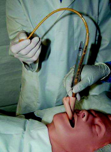 The Laryngeal Mask Airway (LMA™) and Other Extraglottic (Supraglottic ...