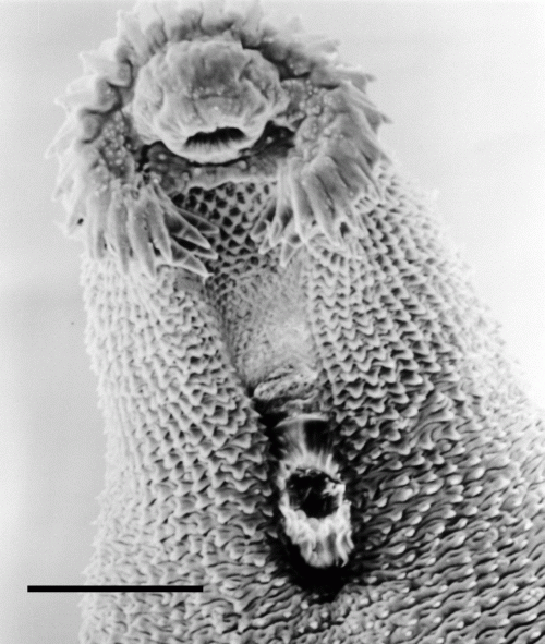 Echinostomes: systematics and life cycles | SpringerLink