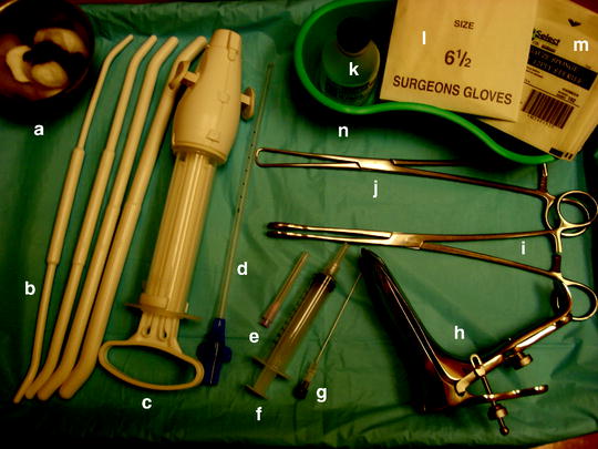 Manual Vacuum Aspiration (MVA) Abortion | SpringerLink