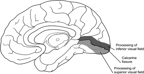 Deficits in Visuospatial/Visuoconstructional Skills and Motor Praxis ...