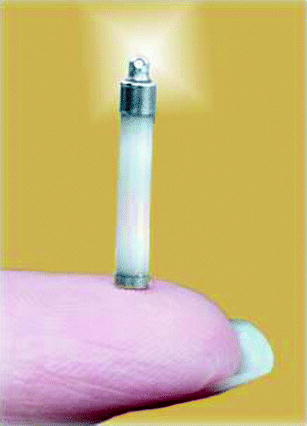 The Bion® Microstimulator and its Clinical Applications | SpringerLink