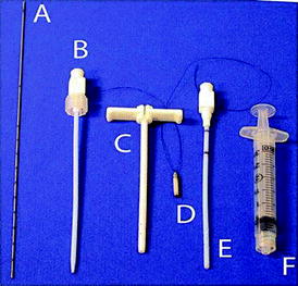 The Bion® Microstimulator and its Clinical Applications | SpringerLink