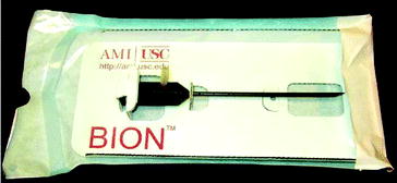 The Bion® Microstimulator and its Clinical Applications | SpringerLink