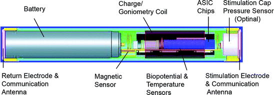 The Bion® Microstimulator and its Clinical Applications | SpringerLink