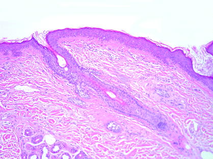 Normal Cutaneous Histology | SpringerLink