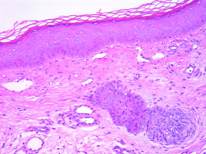 Normal Cutaneous Histology | SpringerLink