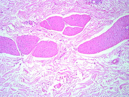 Normal Cutaneous Histology | SpringerLink