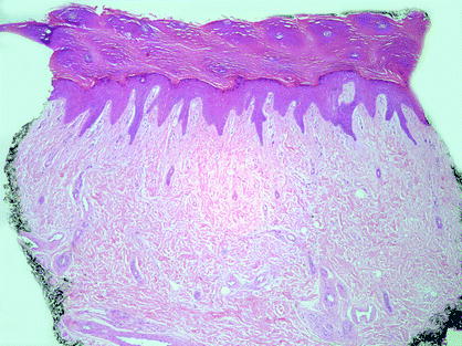 Normal Cutaneous Histology | SpringerLink