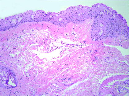 Normal Cutaneous Histology | SpringerLink