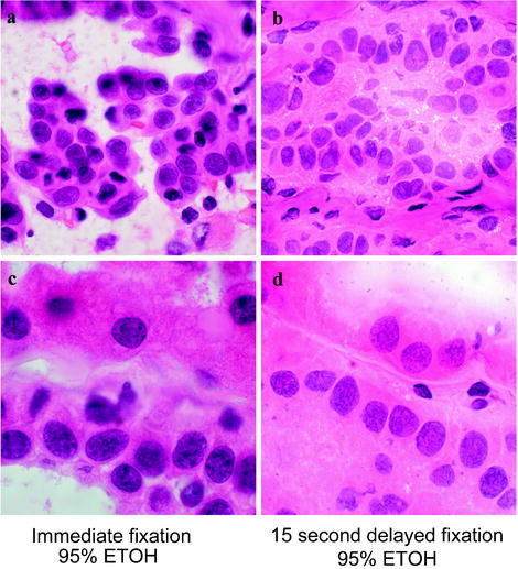 Fixation, Staining and Coverslipping of Frozen Section Slides ...