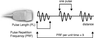 Basics of Ultrasound Imaging | SpringerLink