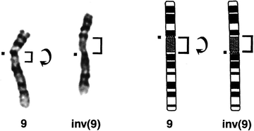 Structural Chromosome Rearrangements | SpringerLink