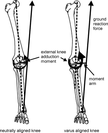 Use of Anthropometry for the Measurement of Lower Extremity Alignment ...