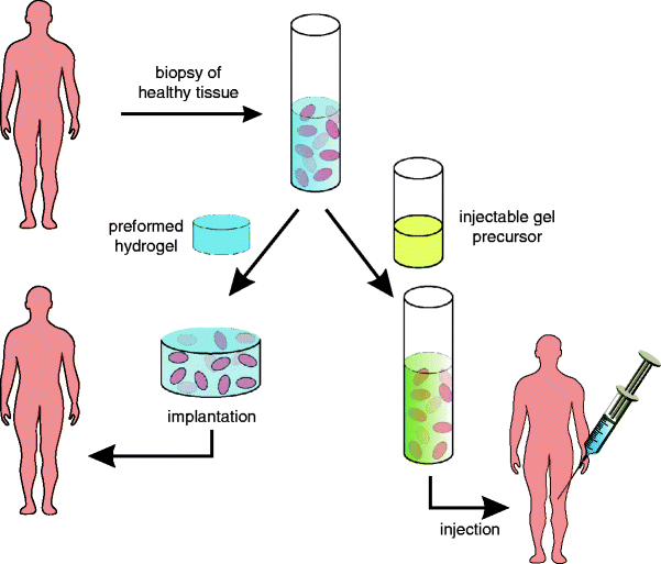 Hydrogels for Tissue Engineering Applications | SpringerLink