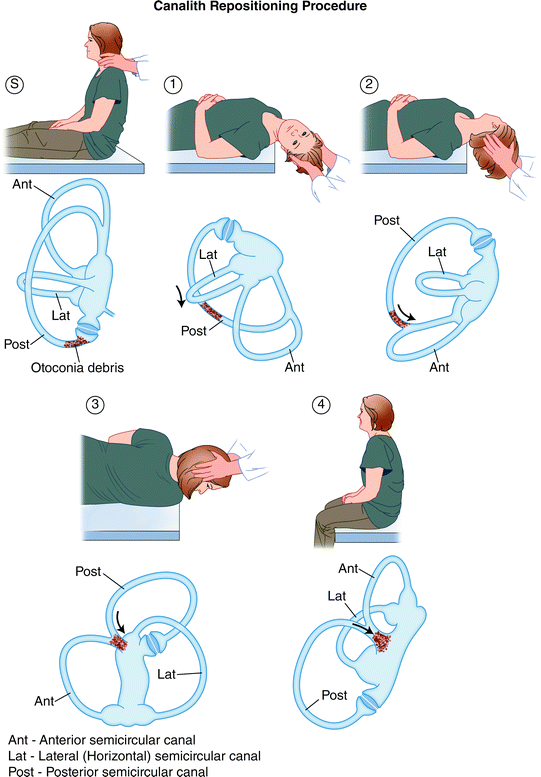 Common Symptoms in the Neurology Clinic | SpringerLink