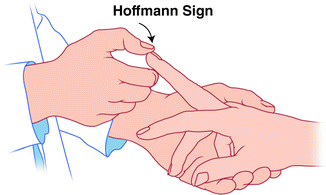 Neurologic Examination | SpringerLink