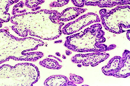 Chorionic Villi: Histology and Villous Development | SpringerLink