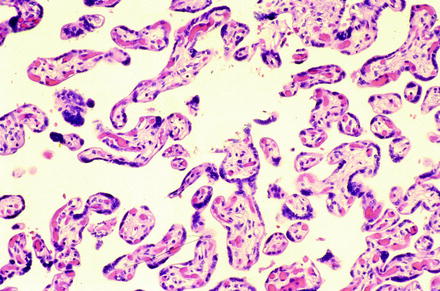 Chorionic Villi: Histology and Villous Development | SpringerLink