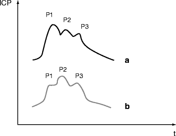 Intracranial Pressure Measurement | SpringerLink