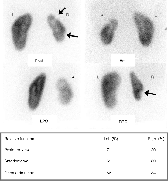 How to Do a DMSA Scan | SpringerLink