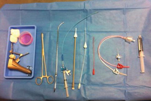 Hysterosalpingography | SpringerLink